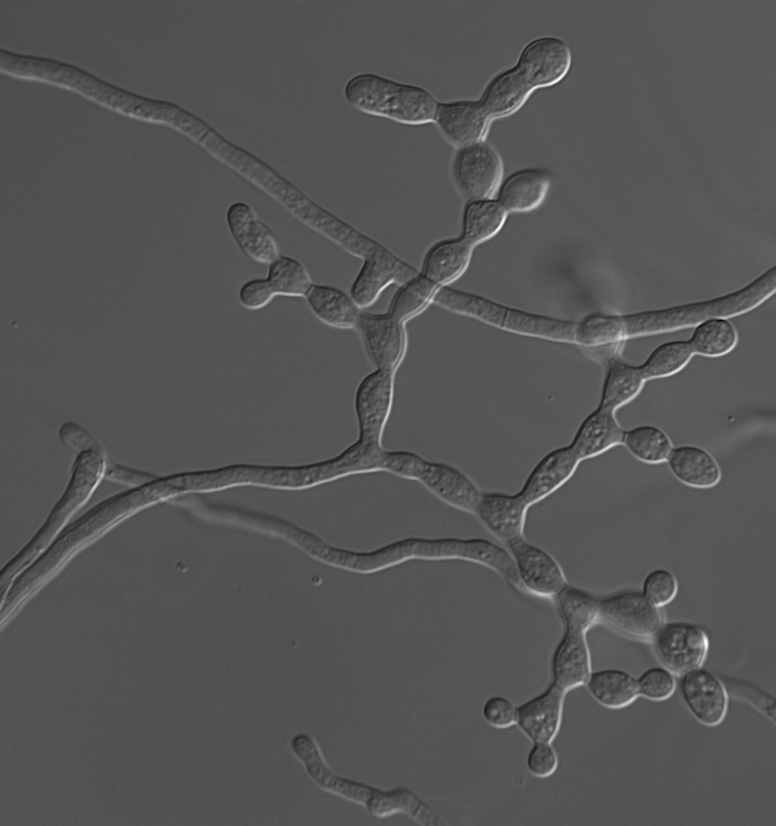 Neurospora crassa – European Conferences on Fungal Genetics